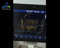 China GE Vivid S6 Ultrasound Machine Repair Interference In CW Mode Replace PIB Board for sale