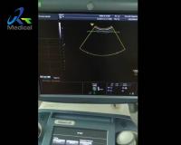 China GE Voluson E8 Ultrasound machine Repair Crash During Control Panel And Touch Screen Unusable for sale