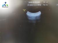China GE RAB4-8-RS 4D Ultrasound Transducer Repair Cardiovascular Ultrasound Machine for sale