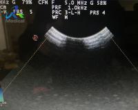 China Biosound Biosound CA123 Ultrasound Probe Repair Service Replace Crystal Lens Cable for sale