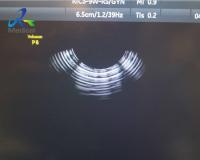 China GE RIC5-9W-RS Ultrasound Probe Repair Monitor Dome Crystal for sale