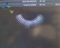 China Gynaecology Ultrasound Probe Repair GE RIC5-9W-RS 4D Monitor Strain Relief Repair Service for sale