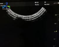 China Obstetrics GE 8C-RS Ultrasound Probe Repair Lens And Cable Repair Service for sale