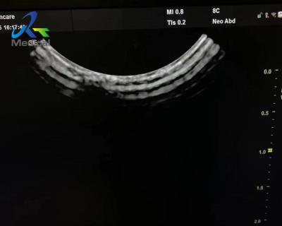 China Obstetrics GE 8C-RS Ultrasound Probe Repair Lens And Cable Repair Service for sale