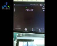 China Ultrasound Image Without Echo Ultrasound Machine Repair Replace RFM Board for sale