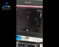 China EPIQ 5 Ultrasound Machine Repair Abnormal Image Snowflake Interference Replace ACQ for sale