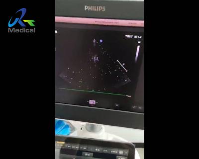 China EPIQ 5 Ultrasound Machine Repair Abnormal Image Snowflake Interference Replace ACQ for sale