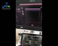China EPIQ 5 Ultrasound Machine Repair Abnormal Image Snowflake Interference Replace ACQ for sale