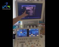 China IE33 Ultrasound Machine Repair Small Parts Probe Image Loss for sale