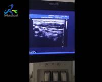 China IE33 Ultrasound Machine Repair Small Parts Probe Image Loss for sale