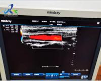China Abnormal Image Ultrasound Machine Repair Service Mindray DC-3 for sale