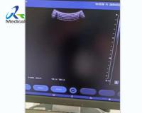 China Siemens X300 Ultrasound Machine Repair Service Unable To Enter The System After Booting for sale