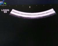 China GE Vivid E90 C1-6-D Convex Array Ultrasound Probe Repair Lens Replacement for sale