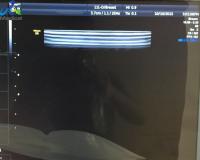 China Original Linear Array Ultrasound Probe Medical Parts Probe Repair GE Logiq E9 11L-D for sale
