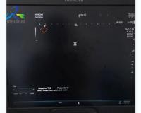 China All Probe Images No Echo Ultrasound machine Repair System Aloka ARIETTA 70 for sale