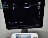 China All Probe Images No Echo Ultrasound machine Repair System Aloka ARIETTA 70 for sale