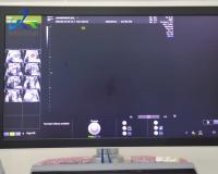 China GE Voluson E8 Ultrasound Machine Repair Probe No Echo RFM Faulty for sale