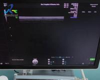 China Medical Ultrasound Machine Repair GE Voluson E8 Absence Of Bright Track Interference for sale
