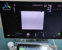 China Medical Ultrasound Machine Repair GE Voluson E8 Absence Of Bright Track Interference for sale