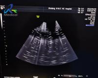 China GE Voluson E10 Ultrasound Machine Repair Abnormal Image Faulty Test for sale
