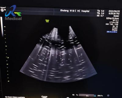 China GE Voluson E10 Ultrasound Machine Repair Abnormal Image Faulty Test for sale