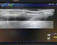 China 5393908 5393912 Ultrasound Repair Service For GE Logiq E9 MRX Board Ultrasound Parts for sale