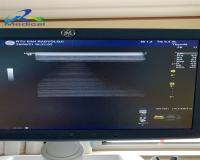 China 5393908 5393912 Ultrasound Repair Service For GE Logiq E9 MRX Board Ultrasound Parts for sale
