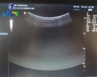 China 4C-RS  GE Curved Array Abdominal Convex Ultrasound Transducer Hospital Instrument Ultrasonic Probes Ndt for sale