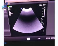 China EPIQ 5 Ultrasound Machine Repair Startup Report Error 025 Replace ACQ for sale