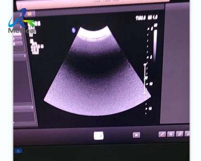China EPIQ 5 Ultrasound Machine Repair Startup Report Error 025 Replace ACQ for sale
