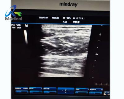 China Mindray DC-3 Abnormal Image Ultrasound Machine Repair Solutions Health Medical Equipment for sale