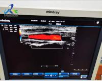 China Mindray DC-3 Abnormal Image Ultrasound Machine Repair Solutions Health Medical Equipment for sale