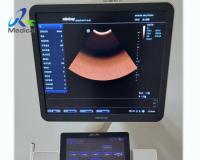 China Doppler Ultrasound Machine Repair Solutions Mindray DC-70 Dark Shadows In The Image Of The Echo Zone for sale