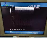 China Medison X6 Ultrasonic Board Repair Solutions Image Interference for sale