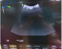 China Medical Ultrasound Equipment Repair Hitachi HI VISION Avius Bright Channels Faulty for sale