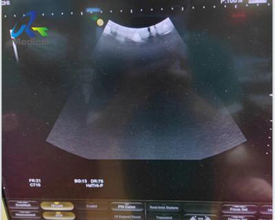 China Medical Ultrasound Equipment Repair Hitachi HI VISION Avius Bright Channels Faulty for sale