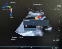 China Invalid Ultrasound Machine Repair Hitachi ARIETTA 60 Occasional Hints That Probe Detection for sale