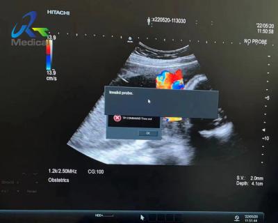 China Invalid Ultrasound Machine Repair Hitachi ARIETTA 60 Occasional Hints That Probe Detection for sale