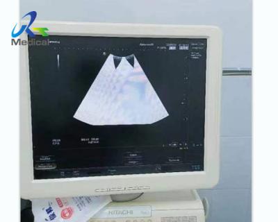 China Doppler Ultrasound Machine Repair RXBF HI VISION Avius Image Bright Channel Interference Radiography Scanner for sale