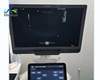 China RM200 10038592 Hospital Ultrasound Machine Repair Service Siemens Oxana Can'T Enter The System At Boot for sale