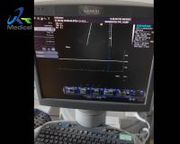 China Siemens S2000 No Spectrum When Using Cw Function medical solutions for sale