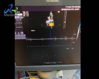China Siemens S2000 No Spectrum When Using Cw Function medical solutions for sale