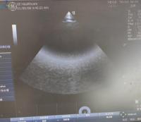 China GE Logiq E Ultrasound Probe Repair 9L-RS Linear Array Transducer Hospital for sale