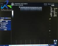 China GE 7L-RC 12MHz Wide Band Linearx Used Ultrasound Probe Medical Hospital Instrument for sale