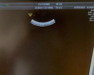 China GE C1-5-D Convex Ultrasound Transducer Probe Ultrasonic Machine Parts for sale