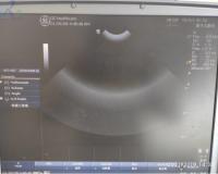 China GE 6S-RS Phased Ultrasonic Transducer Sonography Hospital Clinic for sale