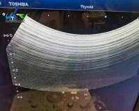 China Toshiba PVT-375BT Convex Array Transducer Probe 6Mhz Hospital Supplies for sale