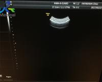 China Wideband Curved Convex Array Used Ultrasound Probe Doctor Supplies Medical Scanner GE RAB4-8-D for sale