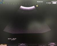 China Hitachi EUP-C715 Abdominal Ultrasound Probe Imaging Diagnosis for sale