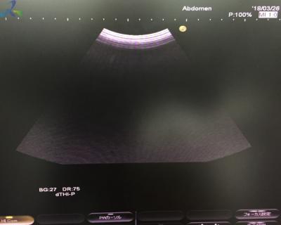 China Hitachi EUP-C715 Abdominal Ultrasound Probe Imaging Diagnosis for sale